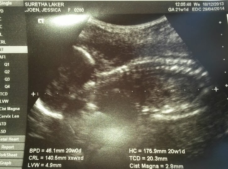 Live, Love, Laugh: 21 Week Scan! ♥