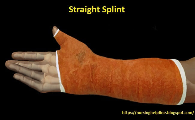 What are the Different Types of Splints with Their Pictures?