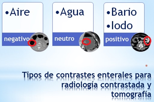 "Pensaba que era una placa": Contrastes radiológicos orales