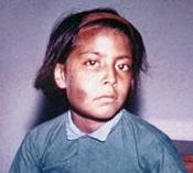 ENFERMEDADES INFECCIOSAS Y MICROBIOLOGIA MEDICA: ENFERMEDAD DE CHAGAS ...