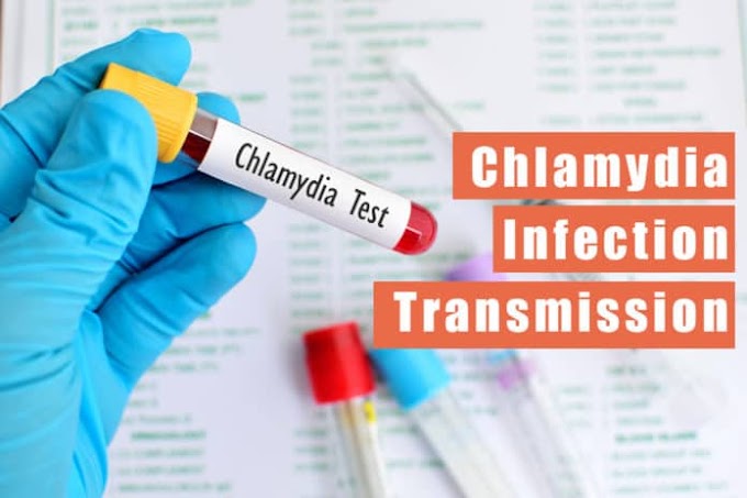 WHAT IS CHLAMYDIA? WHAT ARE THE SYMPTOMS OF CHLAMYDIA