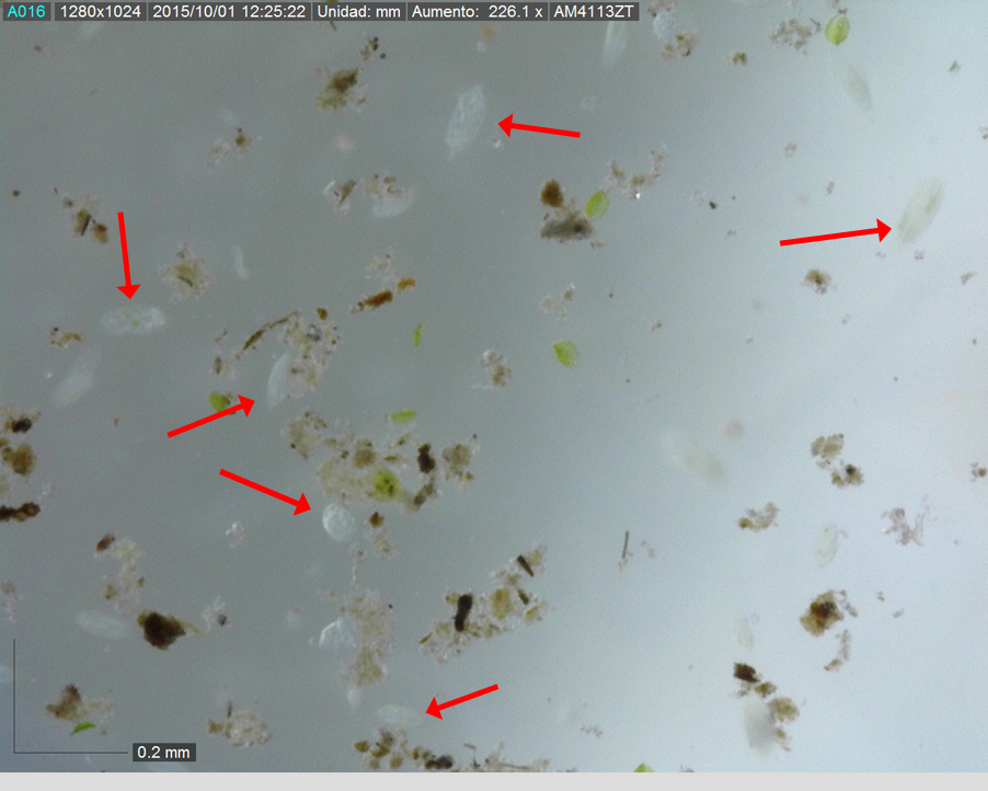 Blog del laboratori de ciències de Llissach: Observació de protozous