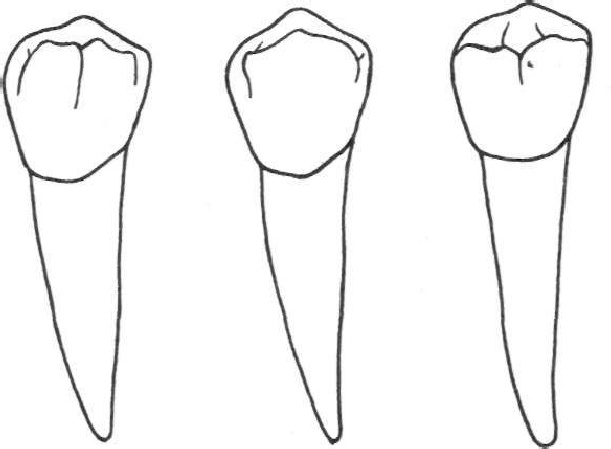 biomateriales: premolares superiores