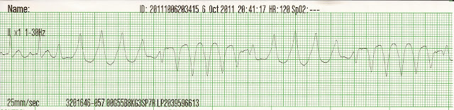 ACLS review: Pulseless VF/VT Part 1