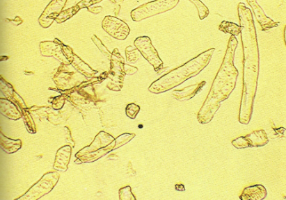 Urine Artifacts ~ Medical Labs Everyday