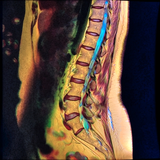 Nevit's blog: Color MRI of the Lumbar vertebrae