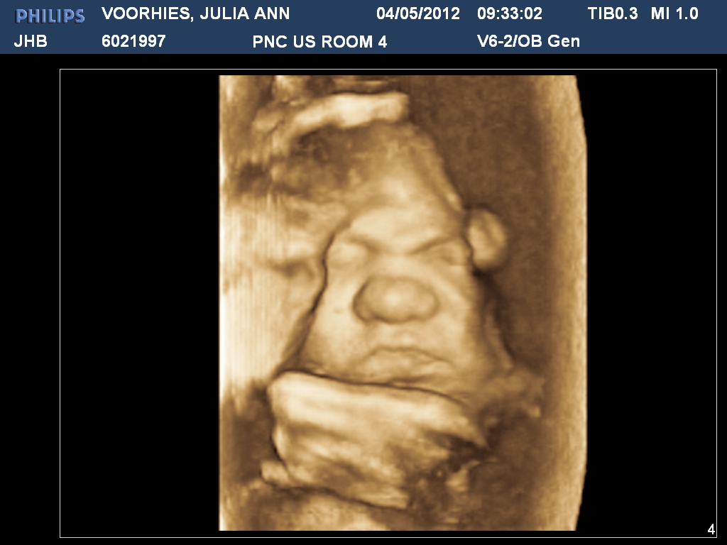 Baby Voorhies: 38 Week Ultrasound
