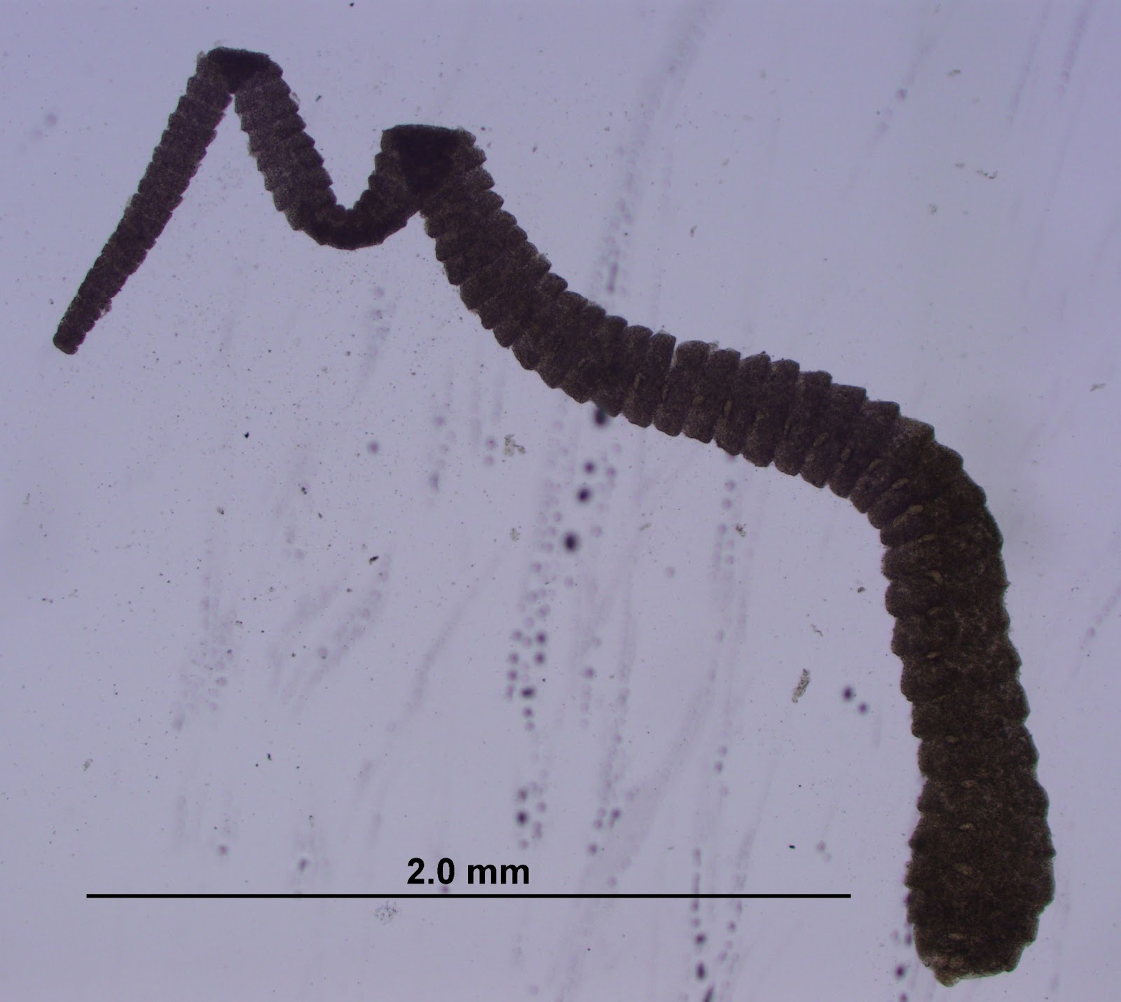 Black Parasites In Stool
