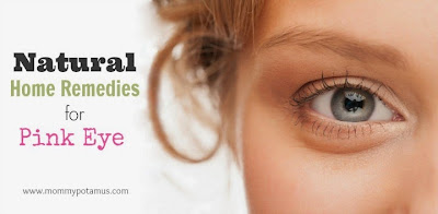 Eri & Ada : 5 Natural Remedies For Pink Eye
