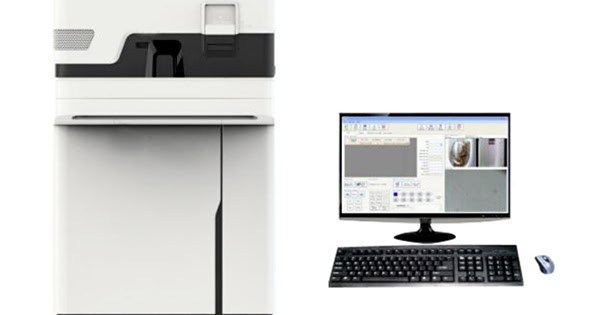 Automated Fecal Analysis for Stool Detection Test