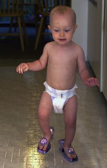 Diaper Rashes Can Happen To Babies & Adults Both ~ Your Health Guide