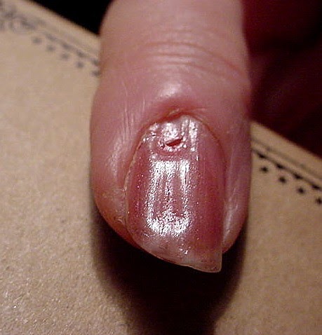 Sally Breslin: My Life: THE UGLY FINGERNAIL AND THE DICTIONARY