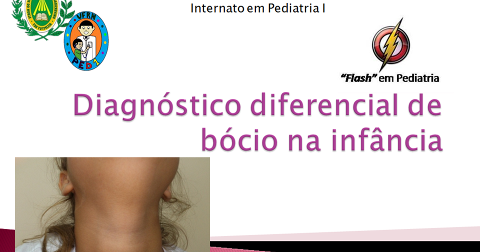 Bócio na infância : Diagnóstico Diferencial