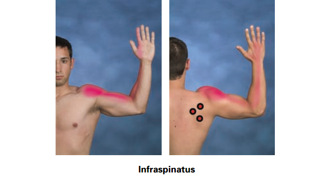 Muscle pain Referral Patterns