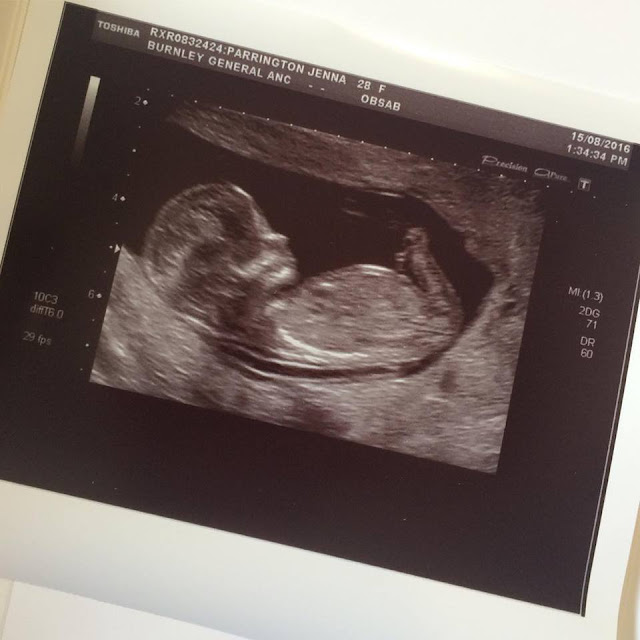 Chic Geek Diary: The 12 Week Scan - Baby #2