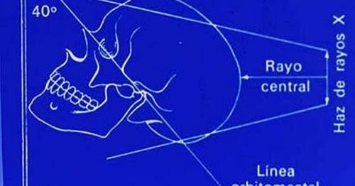 RADIOLOGIA ESTOMATOLOGICA: RADIOGRAFÍA DE WATERS.