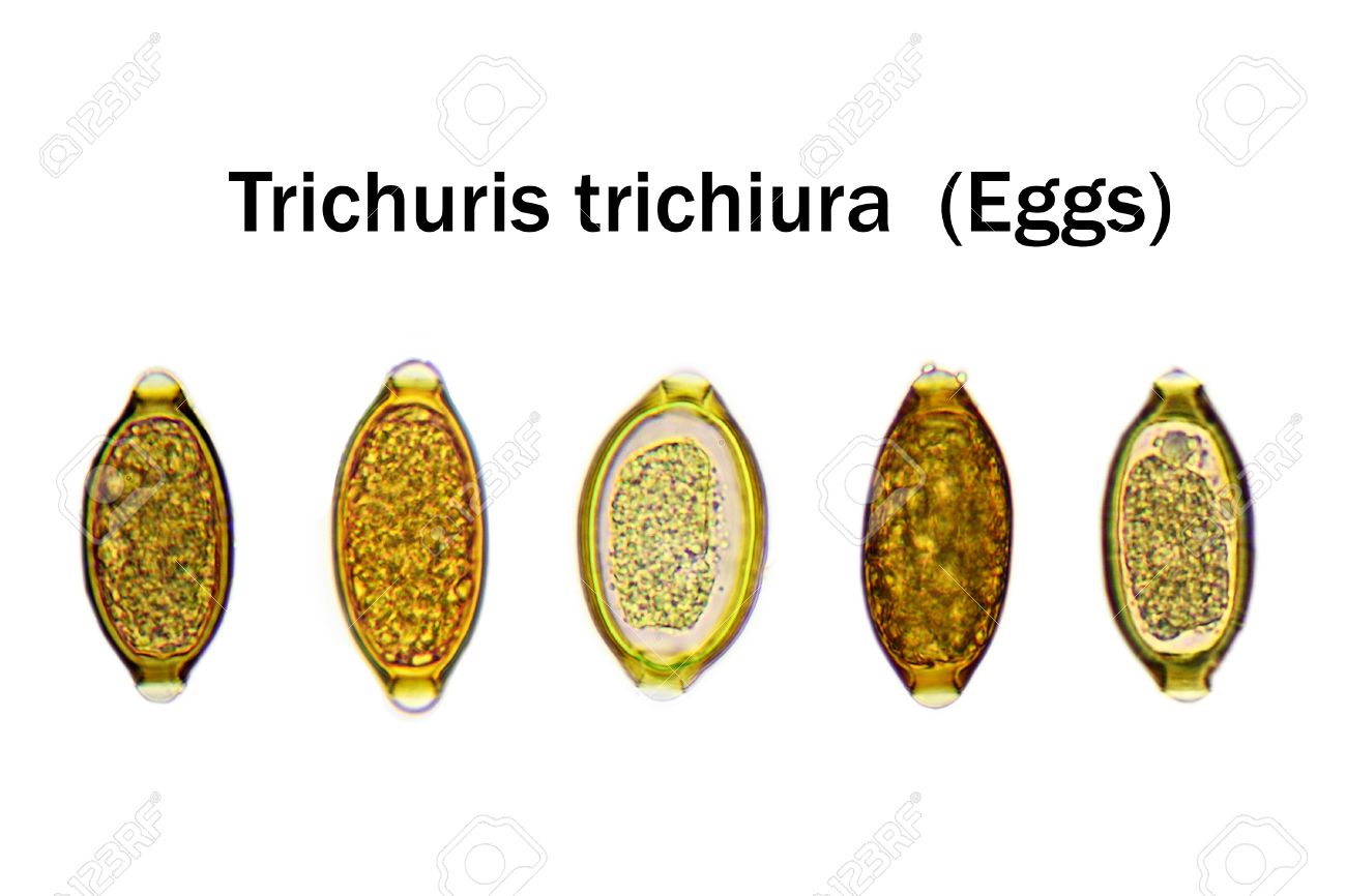 TRICHURIS TRICHIURA - Microbiology Laboratory Turkey