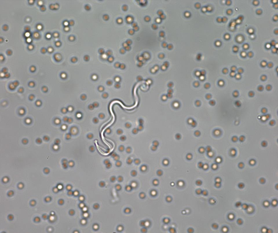 VETERINARY HEMATOLOGY DEXTERVET: Microfilaria in motion