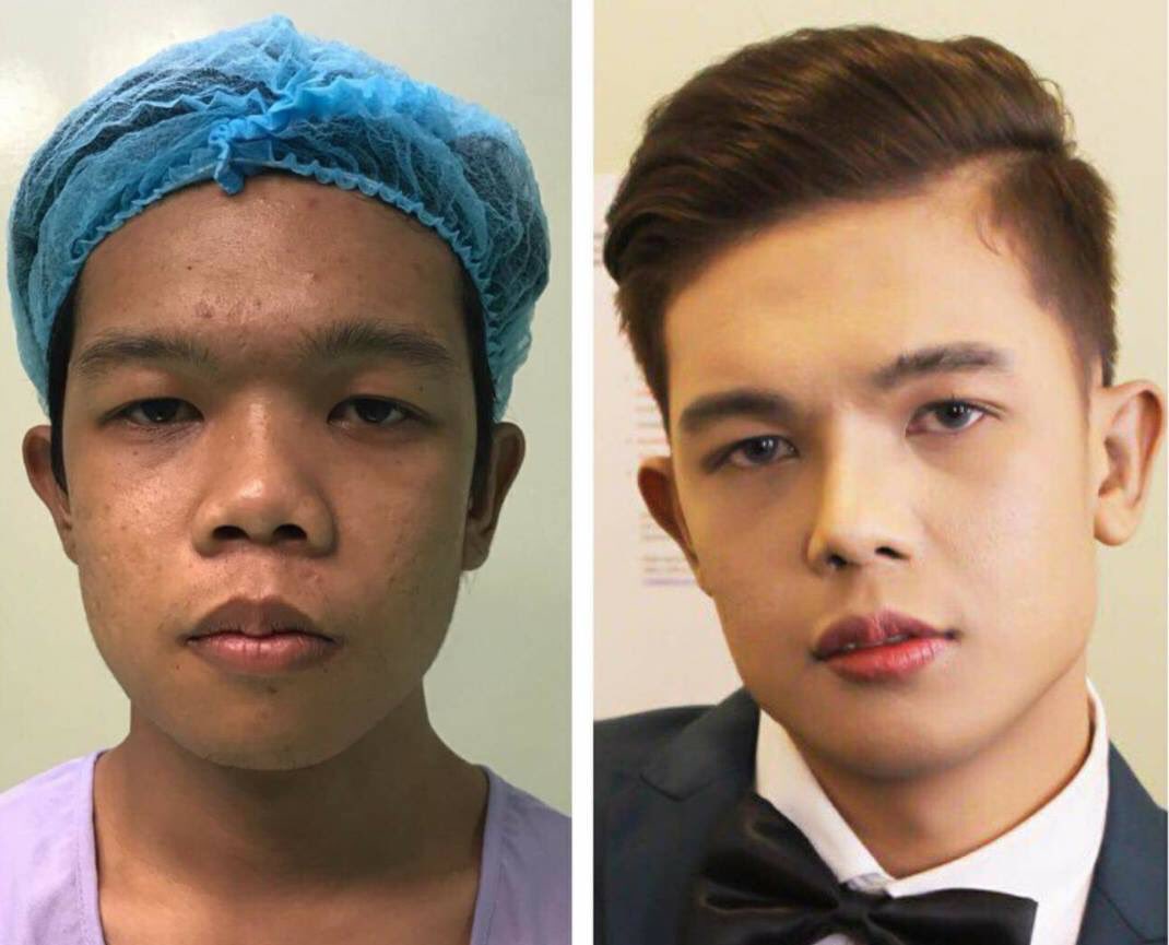 From Marlou Arizala to Xander Ford: From Pinipig to Magnum ~ Wazzup ...