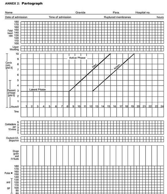 Partograph - Dunia Perubatan