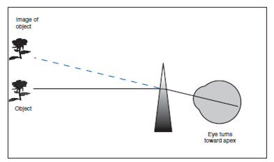 Eye 2 Eye Optometrists: Prism and Progressive Lenses