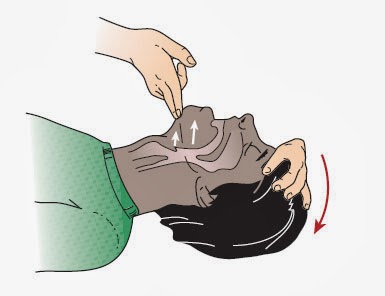 Resuscitation Maneuvers ~ Nursing