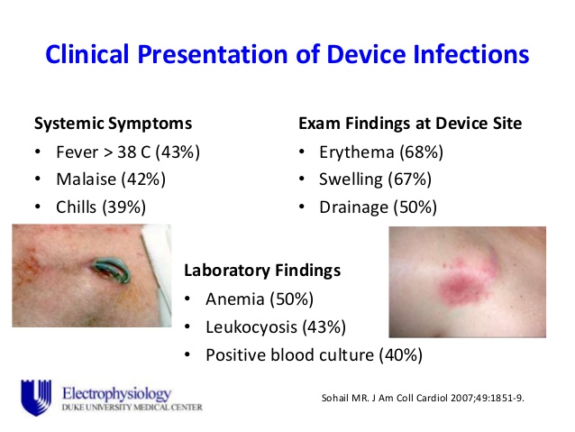 Dr Han Naung @ Henry Han : Electrophysiology and Heart Rhythm : Cardiac ...