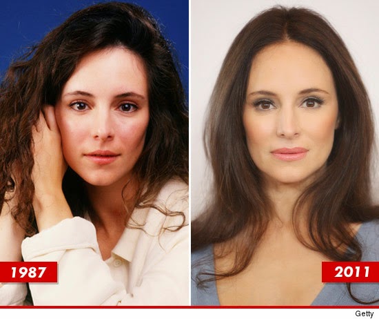 Chatter Busy: Madeleine Stowe Lip Injections