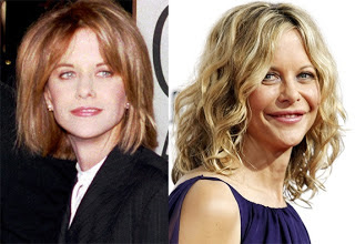 Meg Ryan Plastic Surgery Before and After Facelift and Botox - Star ...