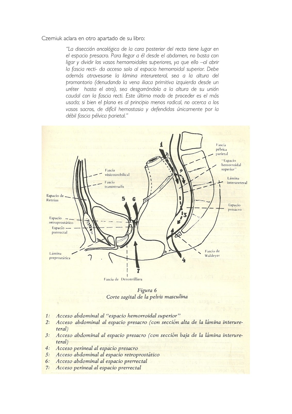 Cuadernos de Anatomía Quirúrgica: La Lámina inter-ureteral de Albanese.