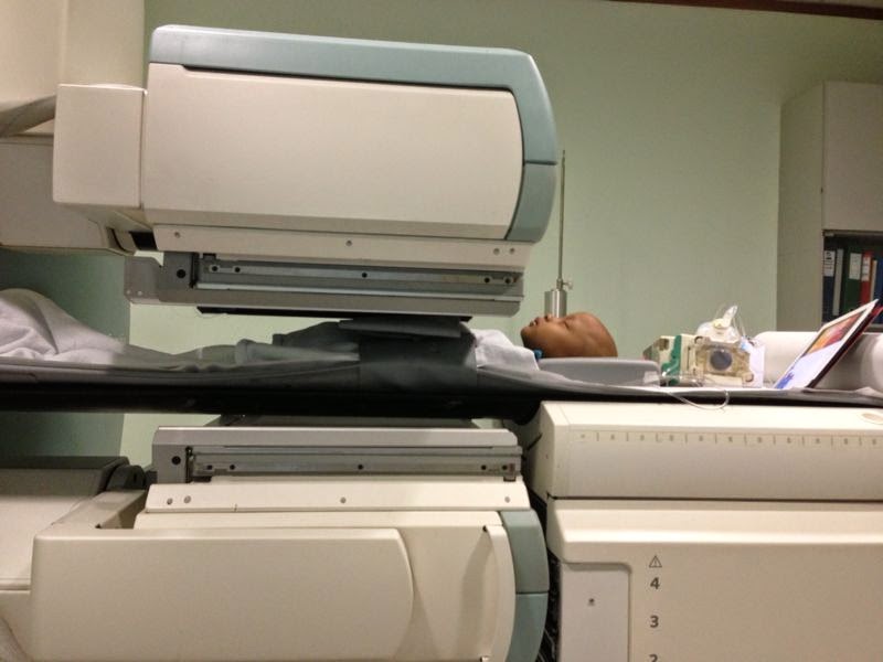 OUR BRAVE FIGHTER EDISON!: Mibg scan