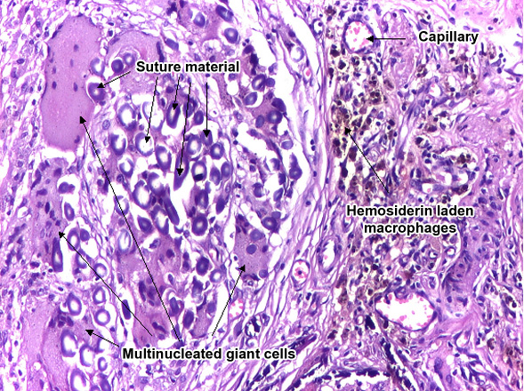 موقع الدكتور أحمد كلحى: صور باثولوجى - ﻿Patholgy Slides : Chronic ...