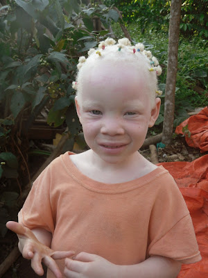 Sherinah's New Hope for Children With Disability Ministry: On Having ...