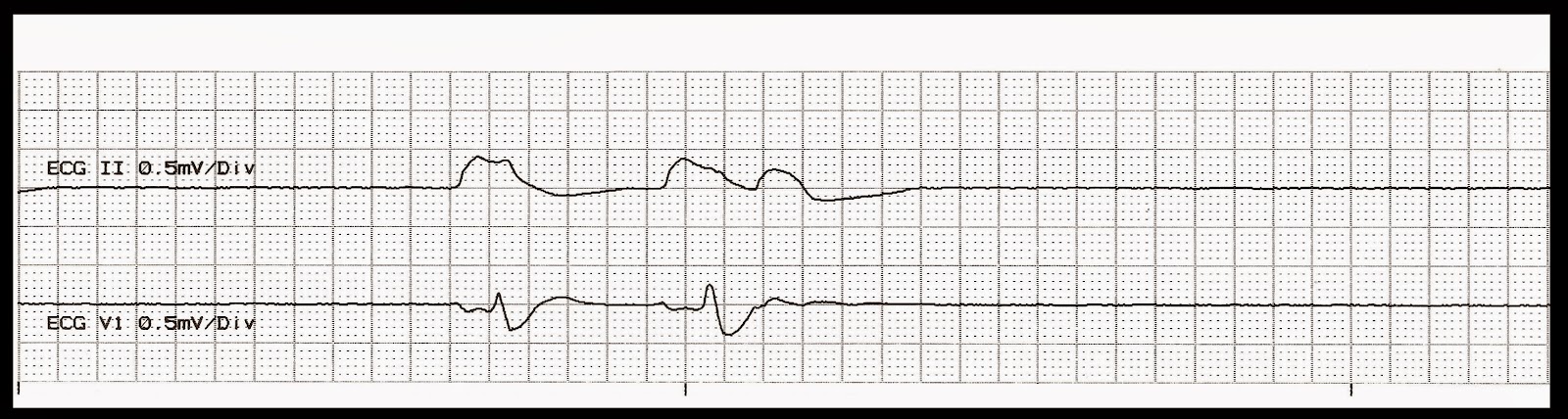 Practice EKG Strips 424