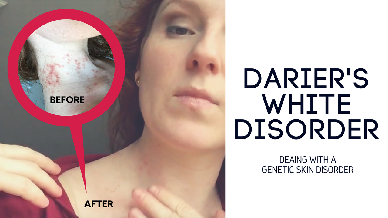 A video update! Things are improving with these three things... ~ My ...