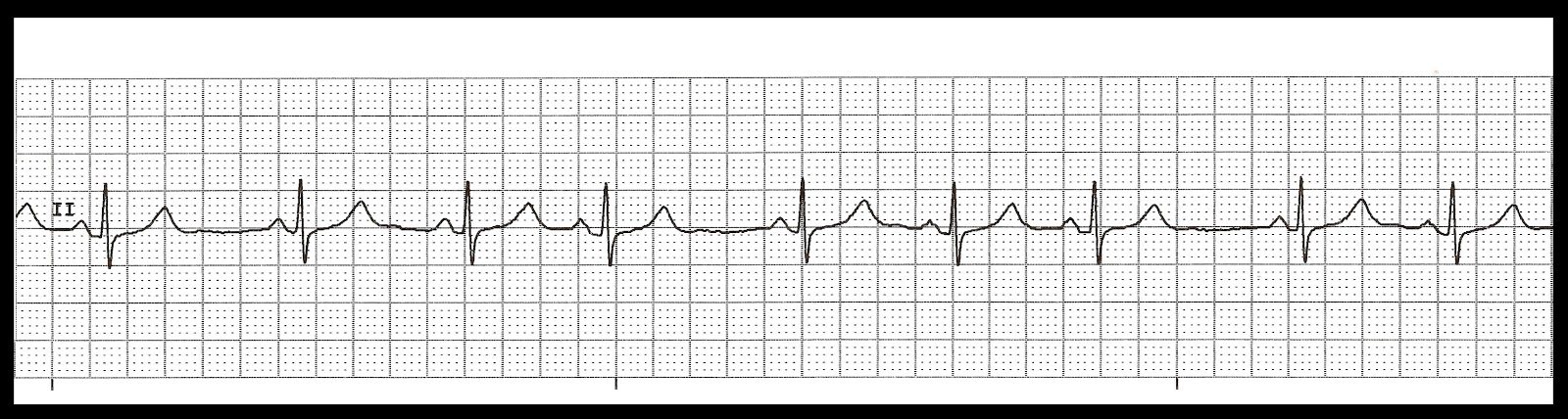 Basic Rhythm Test 26
