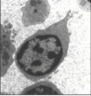 Histology Doodles: Lymphocyte; Electron Microscope