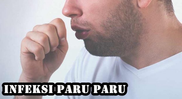 TERAPI INFEKSI PARU PARU