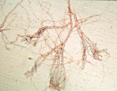 Spore definition - revgaret