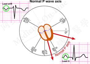 Enciclopédia de ECG - Nomenclatura: Onda P