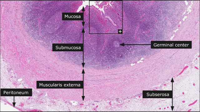 MoyinAdesanyaBiol 3500: The Human Appendix: My Favorite Organ: The ...