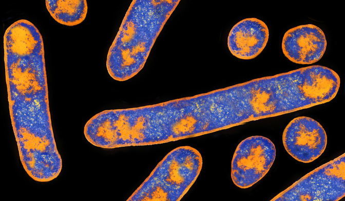 Clostridium botulinum - Alchetron, The Free Social Encyclopedia