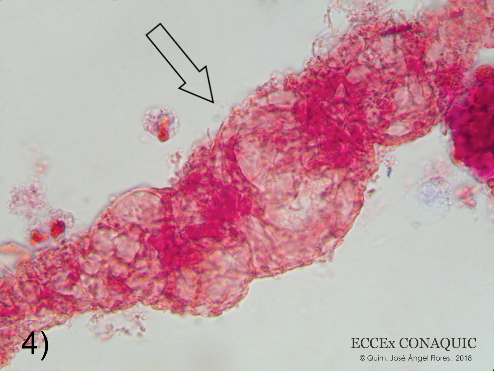 Examen General de Orina: 2018