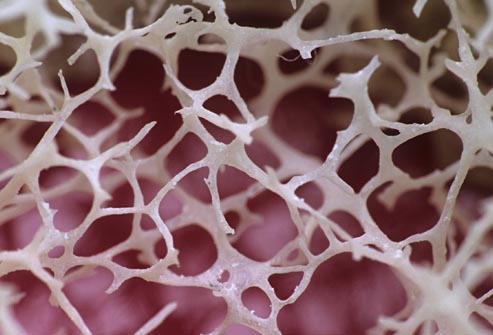 The Science Man's Blog: Bone Marrow Up Close (Picture of the Day: 11/2/12)