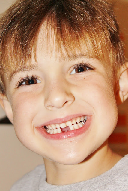 ThePoeFam: "Other than a dimple in a cute little chin, what's more ...