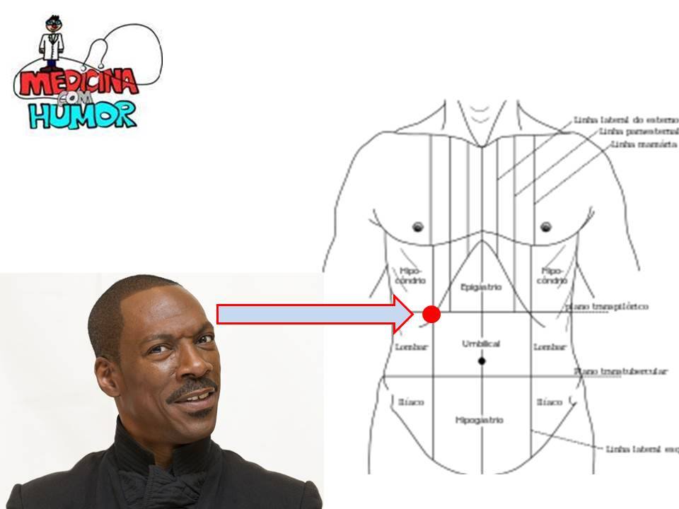 Aprendendo Medicina com Humor: SINAL DE MURPHY