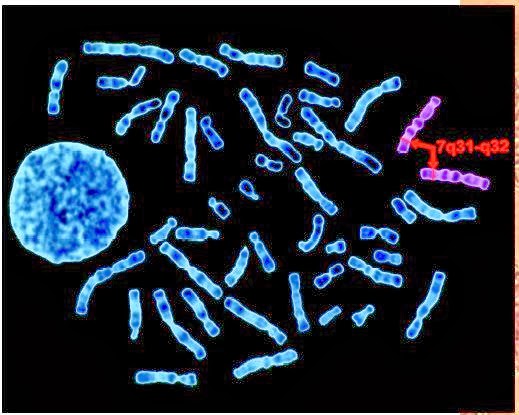 Pengertian, Jenis-jenis dan Contoh Mutasi Gen dan Mutasi Kromosom