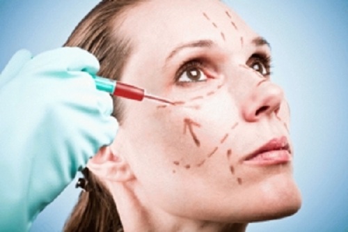 DermaSphere: Vampire Face Lift