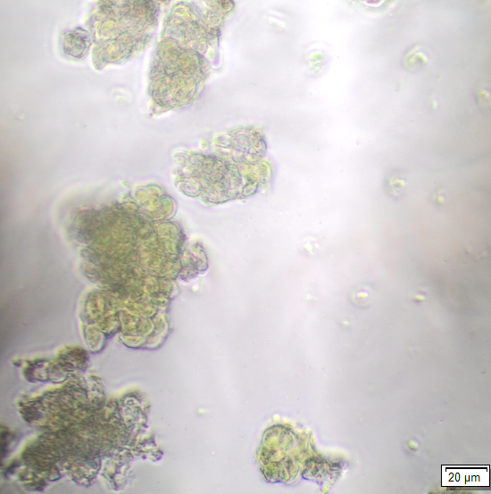 Welcome to the big world of tiny organisms: Specimen #17: Protococcus