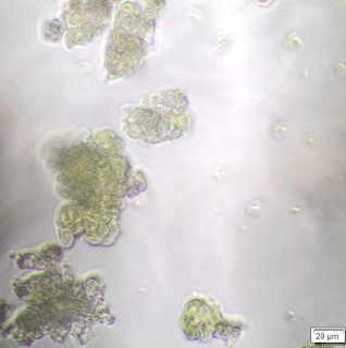 Welcome to the big world of tiny organisms: Specimen #17: Protococcus